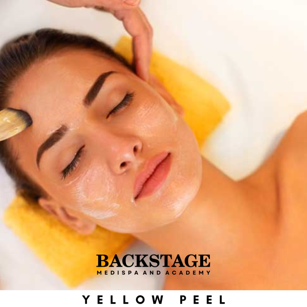 HYPERPIGMENTATION TREATMENT IN DELHI - Backstage Delhi